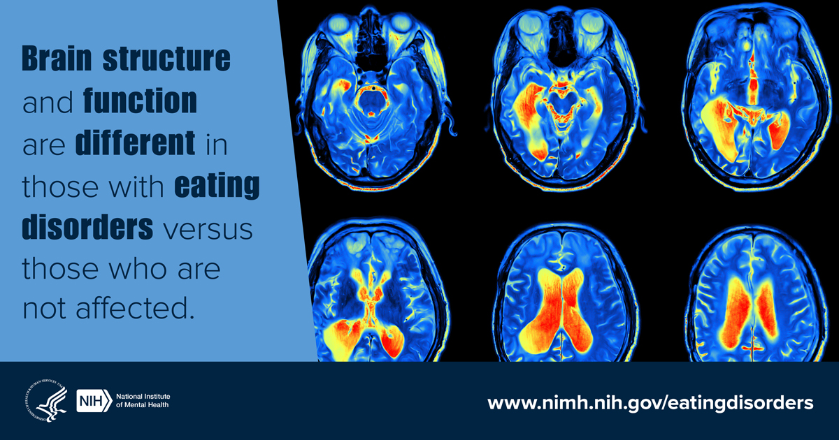 NIMH » Digital Shareables on Eating Disorders
